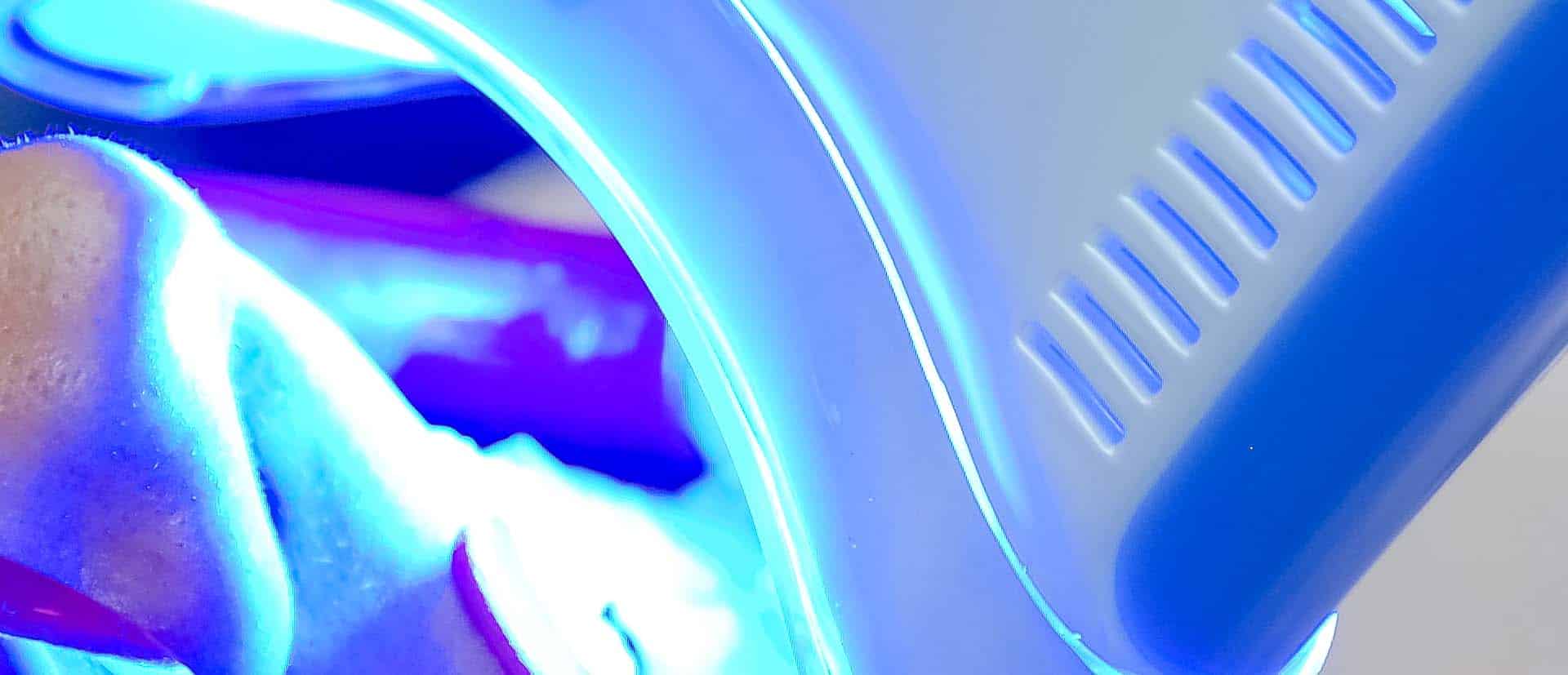 Garland, TX Residents Learn The Benefits Of Professional Teeth ...